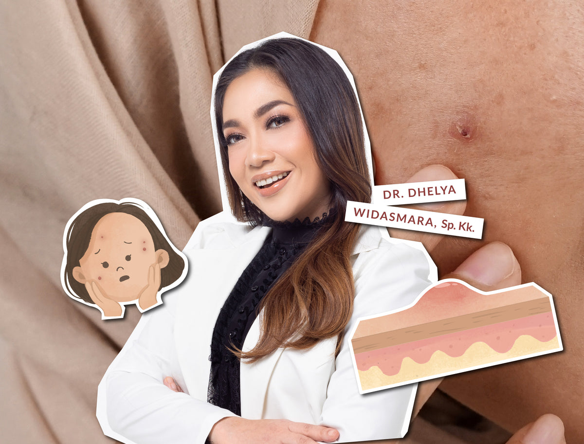 BLP SKIN | ACNE 101 WITH DR. DHELYA WIDASMARA, Sp. Kk. – BLP Beauty